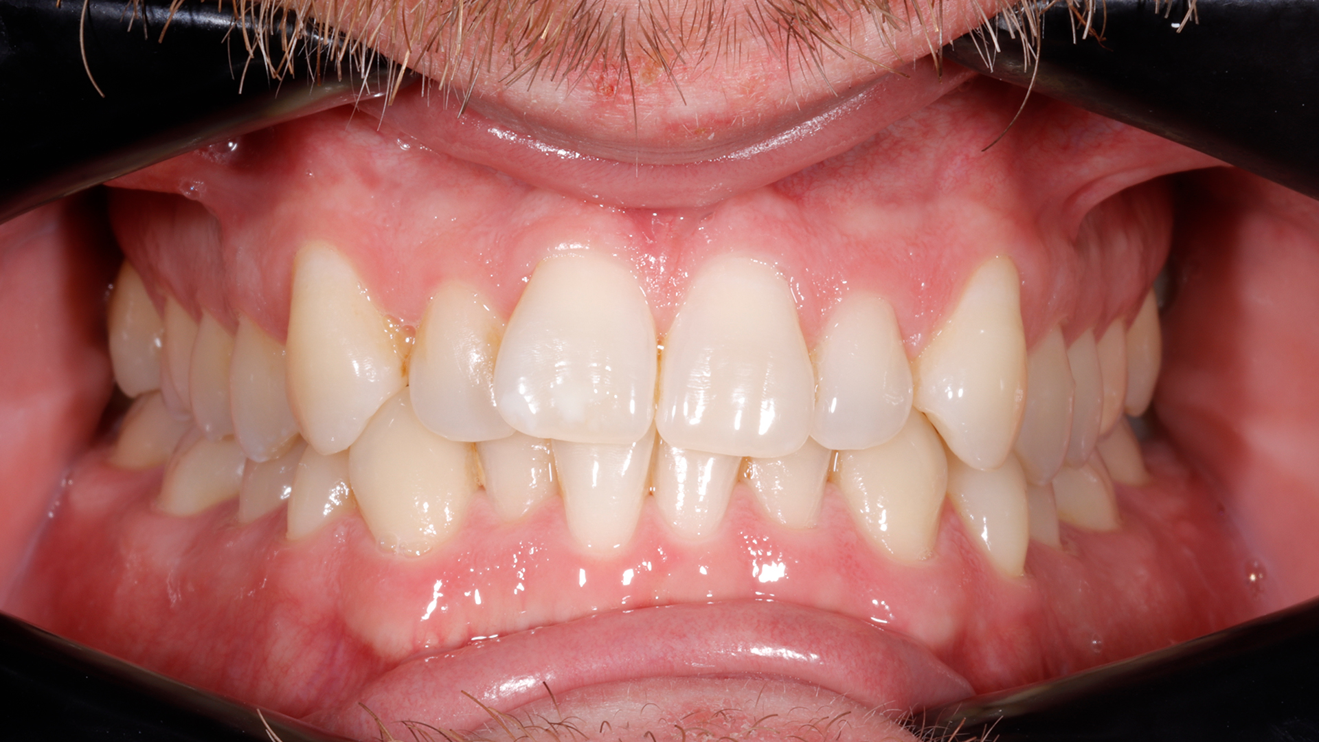 Gallery: East Finchley Smiles Dental Practice.